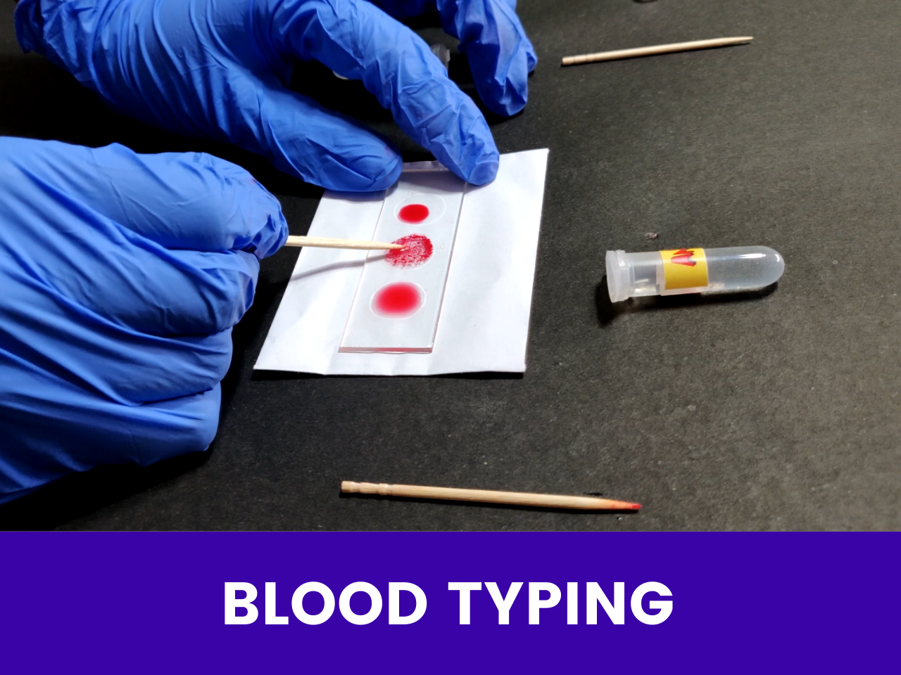 Blood Typing – WitBlox