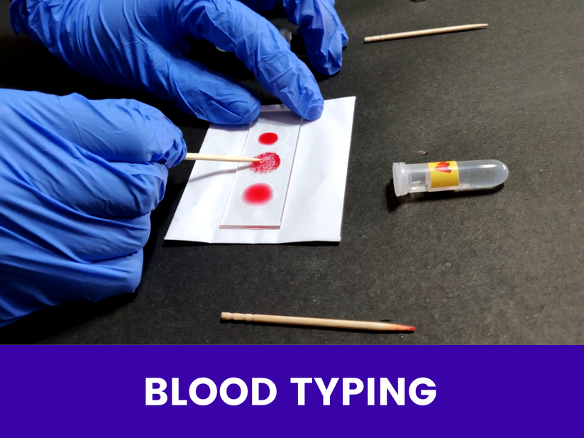 Blood Typing Kit – WitBlox